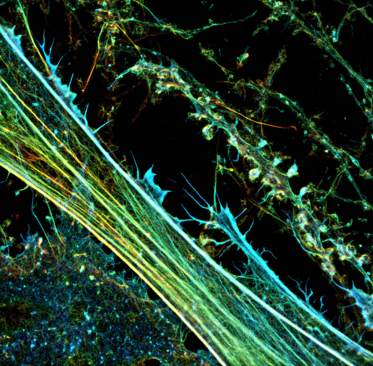 Nano-Scale Imaging | Life Sciences | Solutions | Nikon Instruments Inc.