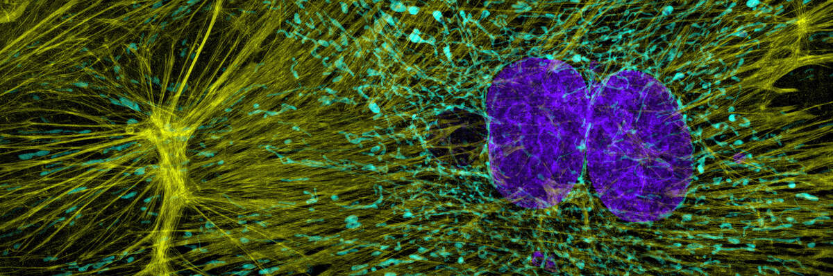 2D Imaging | Applications | Nikon BioImaging Lab - USA | Nikon ...