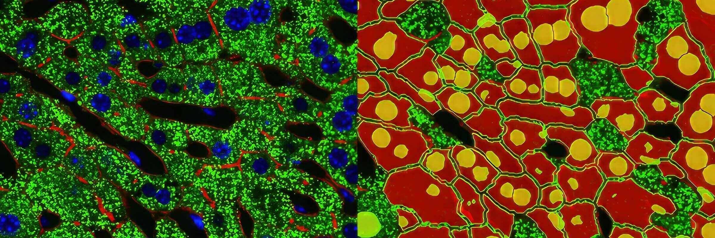 Custom Image Processing and Analysis | Applications | Nikon BioImaging ...