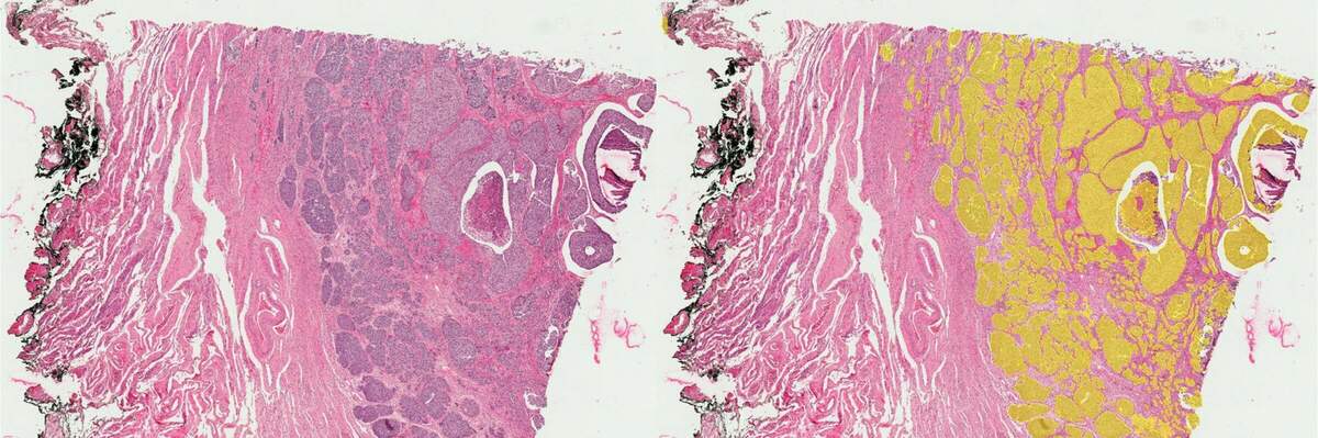 Histological Image Segmentation | Applications | Nikon BioImaging Lab ...