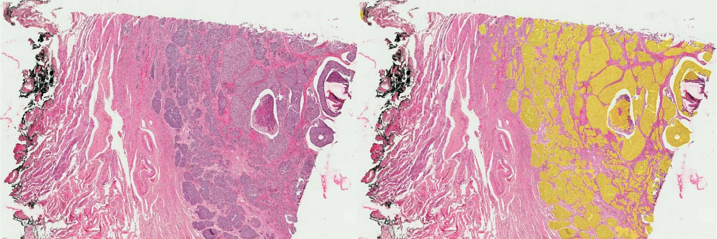 Histological Image Segmentation | Applications | Nikon BioImaging Lab - Europe | Nikon ...