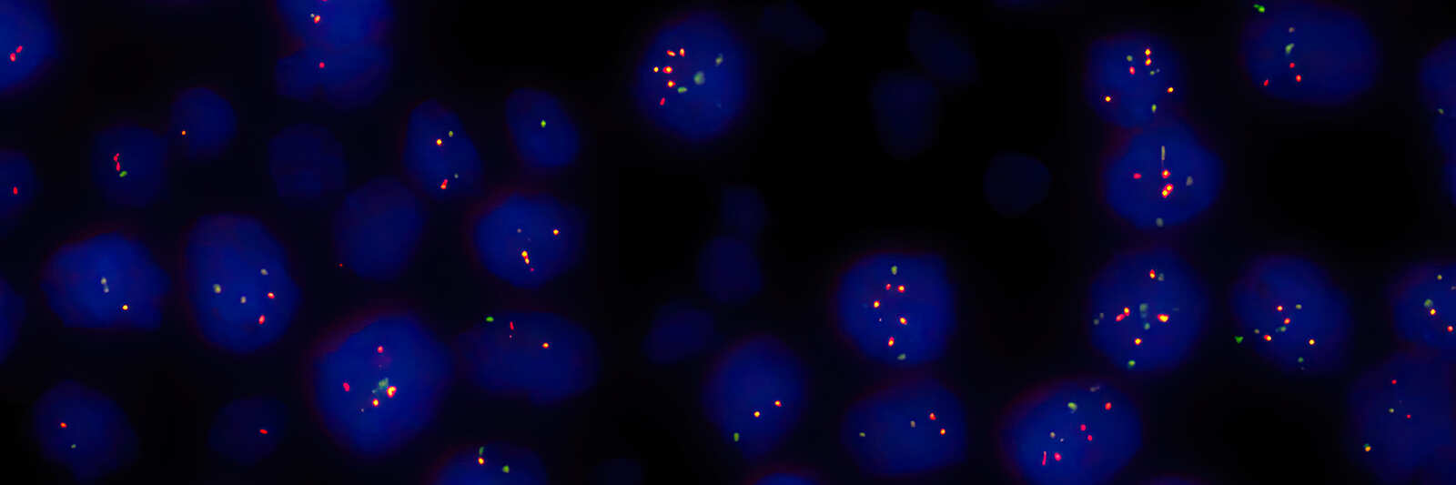 Whole Slide Scanning | Applications | Nikon BioImaging Lab - Europe ...