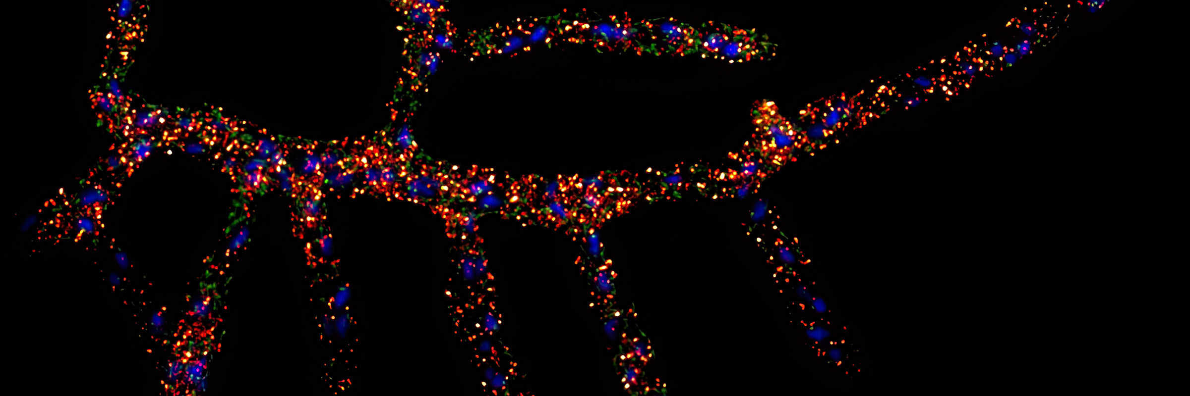 mRNA Quantification (smFISH) for Gene Expression Analysis ...