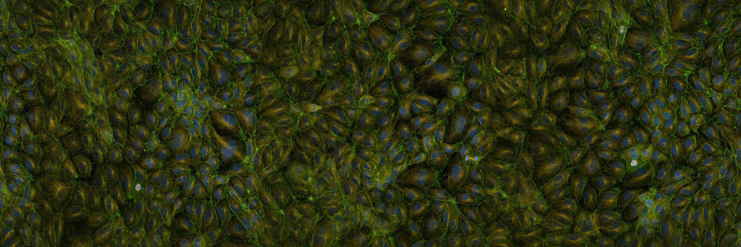 Transendothelial Migration | Applications | Nikon BioImaging Lab ...