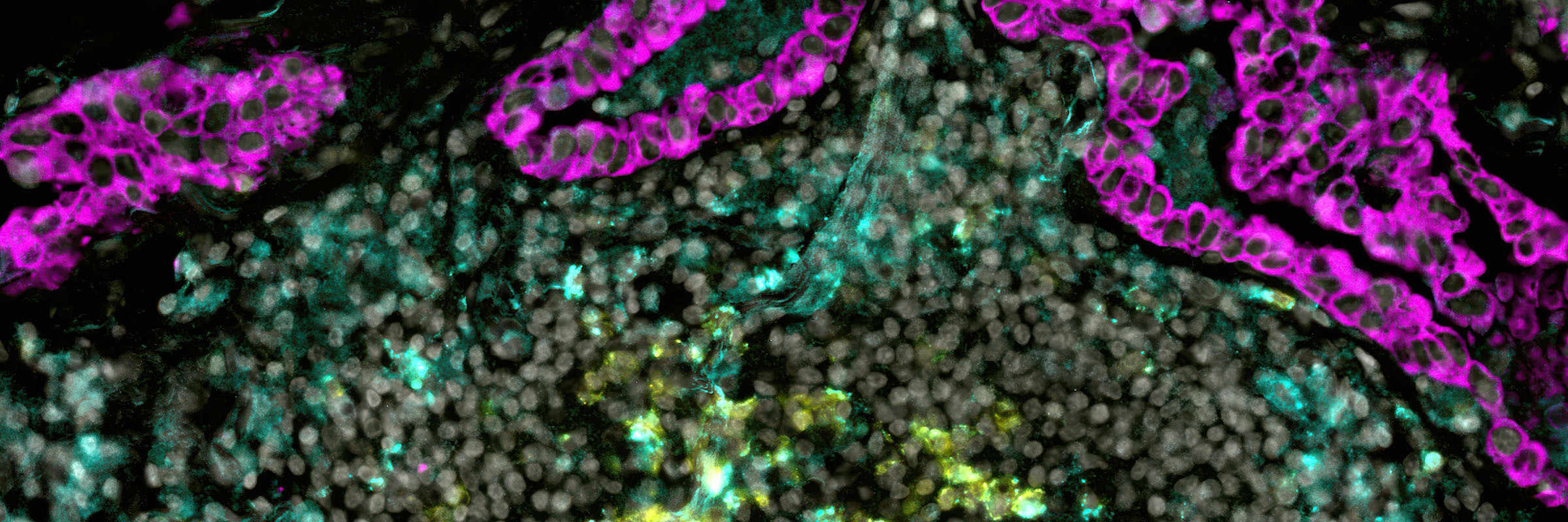 Spatial Biology | Applications | Nikon BioImaging Lab - USA | Nikon ...