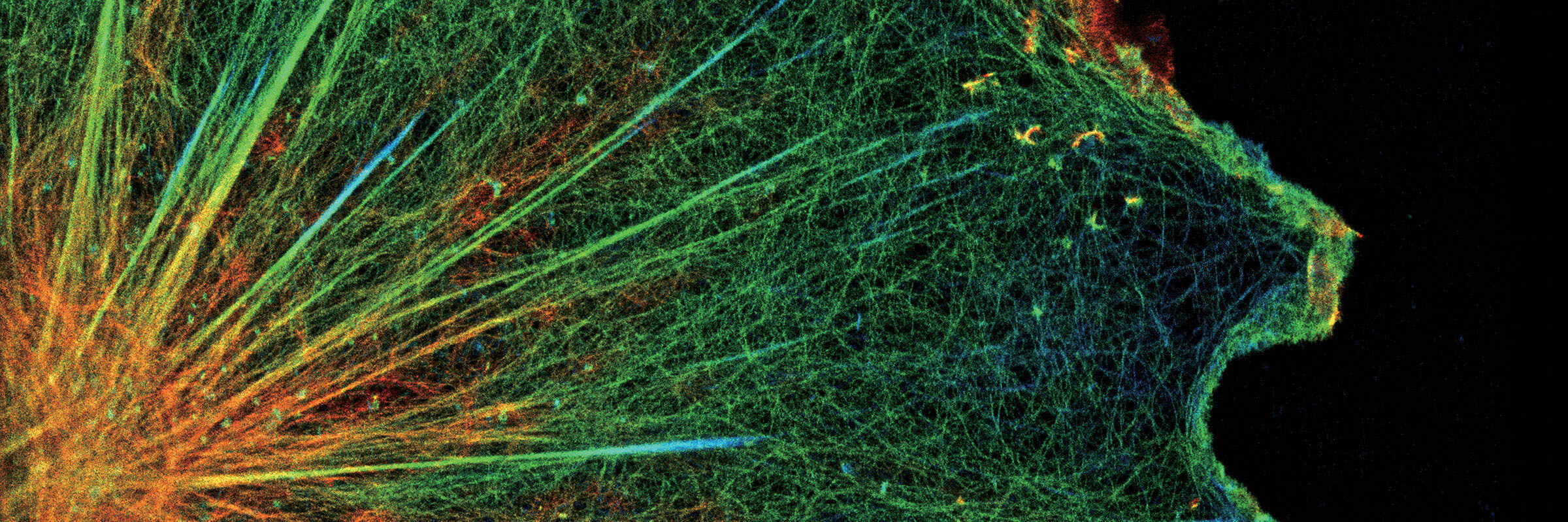 Super-Resolution | Applications | Nikon BioImaging Lab - USA | Nikon ...