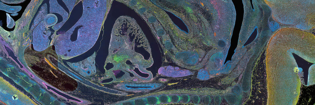 Whole Slide Scanning | Applications | Nikon BioImaging Lab - USA ...