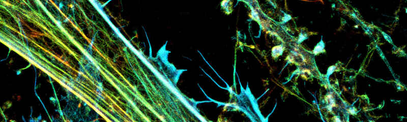 Super-Resolution Microscopes | Microscope Products | Nikon Instruments Inc.