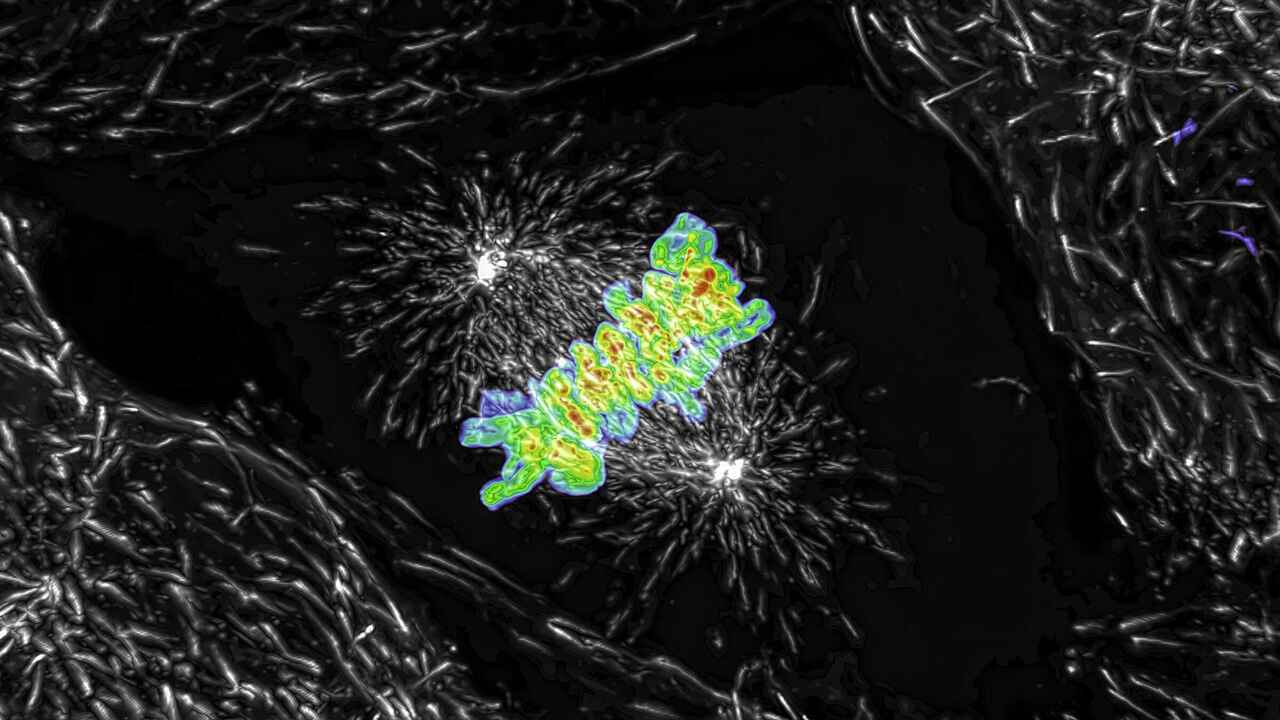 Live Cell Imaging | Life Sciences | Solutions | Nikon Instruments Inc.