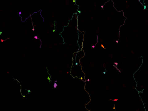 Transendothelial Migration | Applications | Nikon BioImaging Lab ...