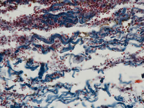 Gallery | Digital Sight 10 | Cameras | Microscope Products | Nikon Instruments Inc.