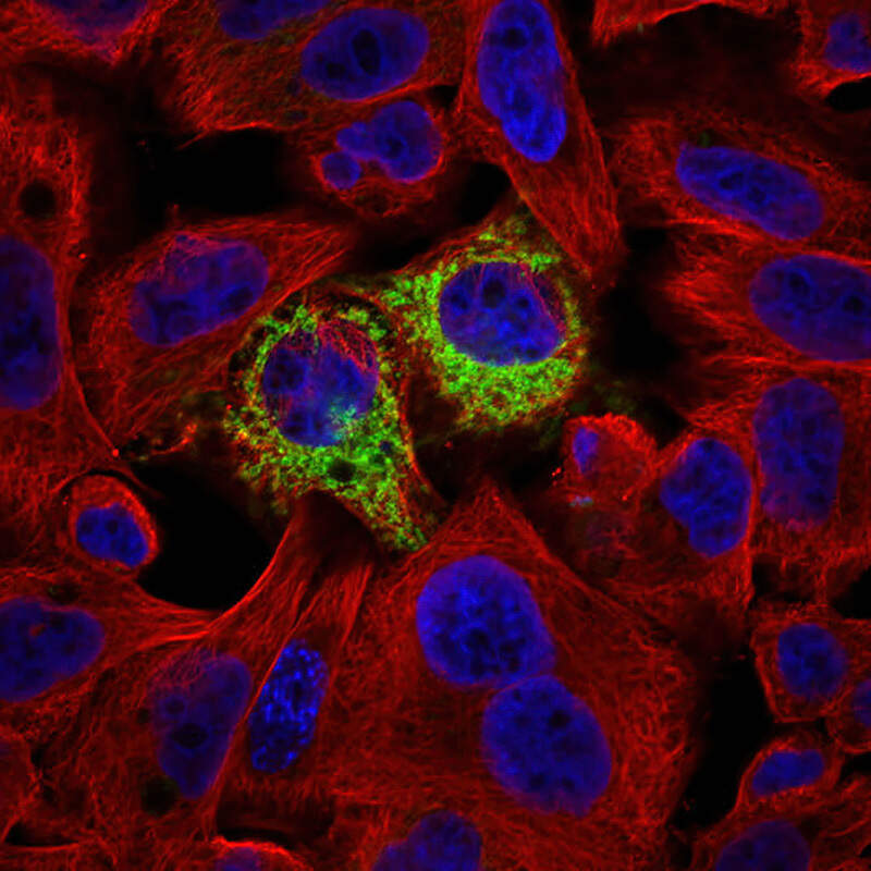 3D segmentation of nuclei in a DAPI-labeled spheroid | Galleries | 니콘 ...