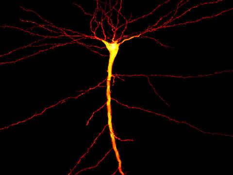 2D Imaging | Applications | Nikon BioImaging Lab - USA | Nikon ...