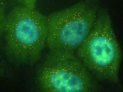 mRNA Quantification (smFISH) for Gene Expression Analysis ...