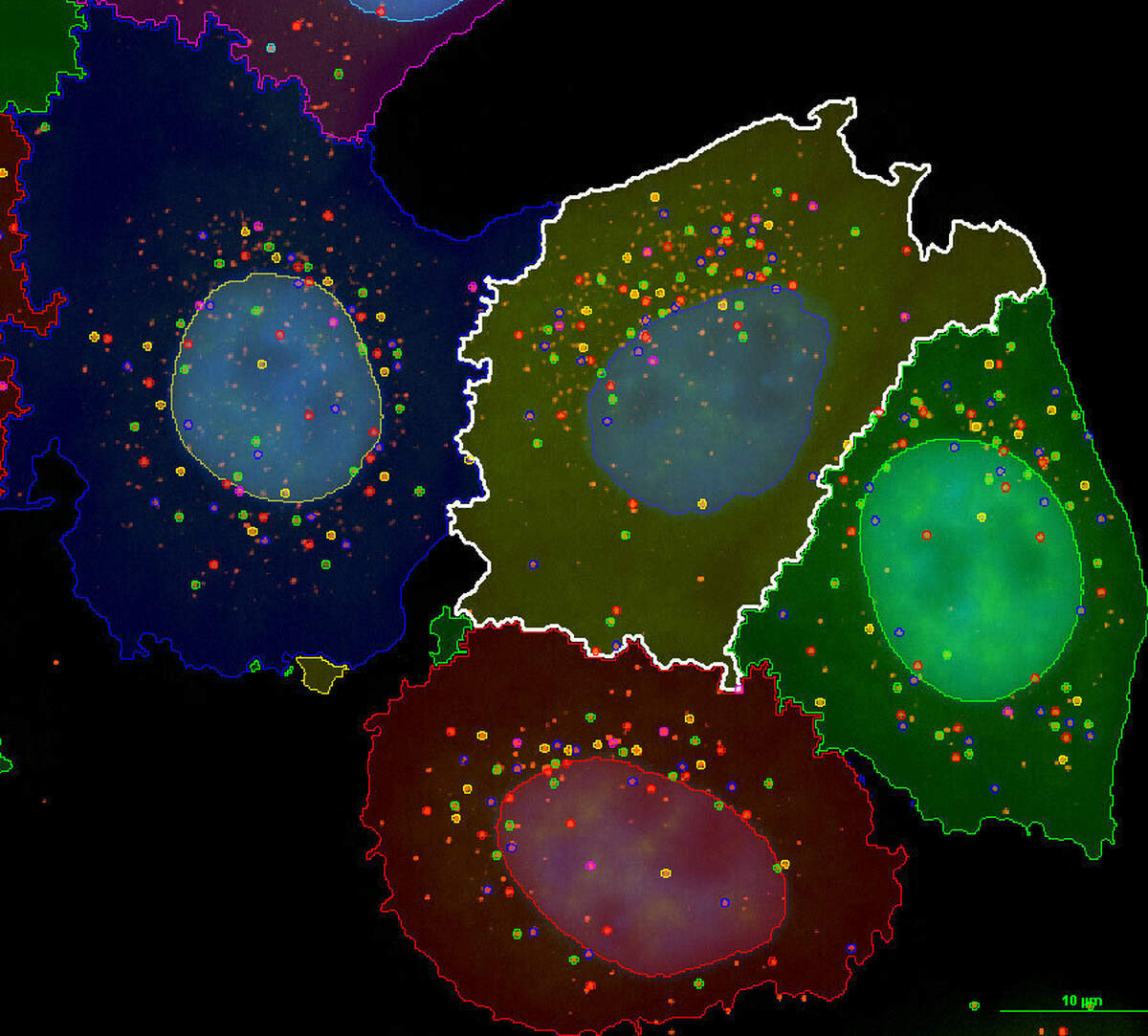 mRNA Quantification (smFISH) for Gene Expression Analysis ...