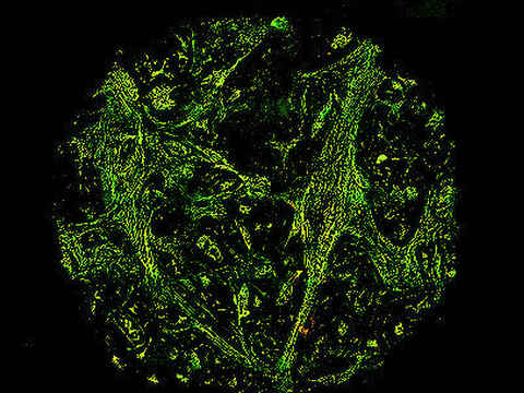 Whole Slide Scanning | Applications | Nikon BioImaging Lab - Europe ...