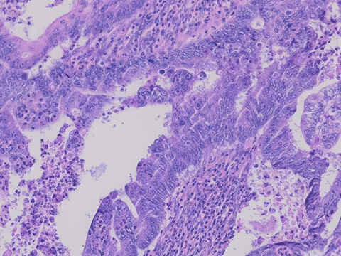 Whole Slide Scanning | Applications | Nikon BioImaging Lab - Europe ...