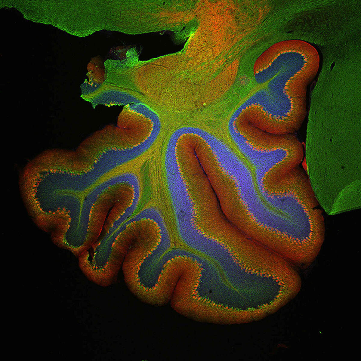Whole Slide Scanning | Applications | Nikon BioImaging Lab - Europe ...