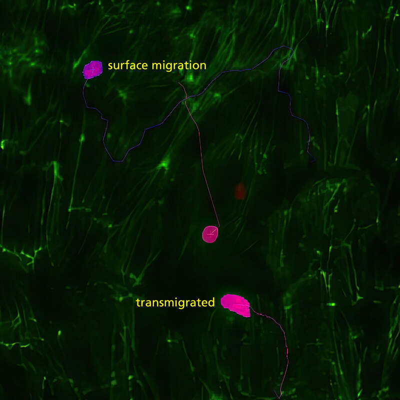 Examples of surface migration and transmigration | Galleries | Nikon ...