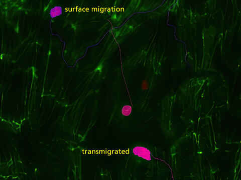 Transendothelial Migration | Applications | Nikon BioImaging Lab ...