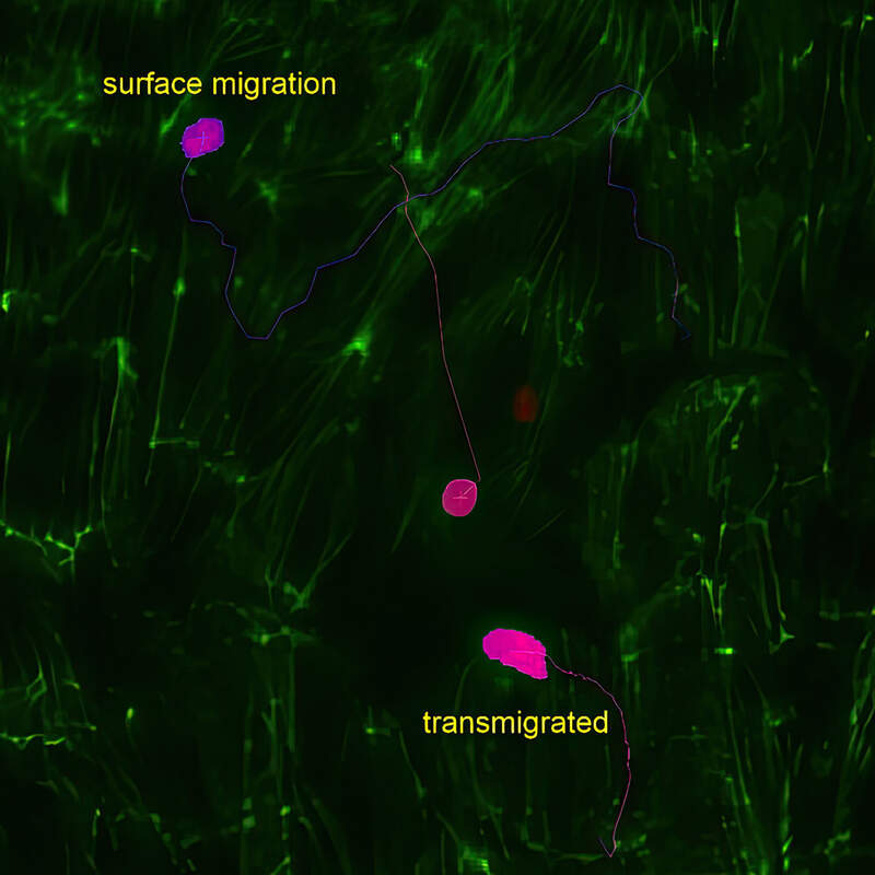 TEM surface migration | Galleries | 니콘인스트루먼트코리아