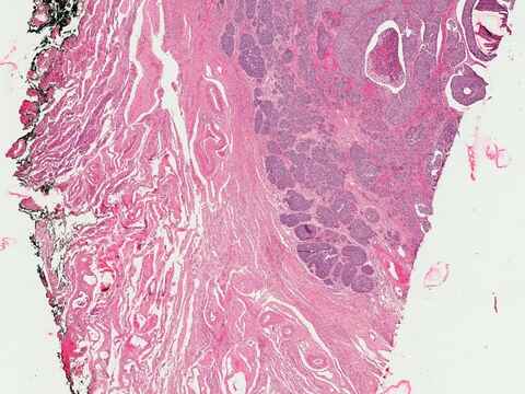 Histological Image Segmentation | Applications | Nikon BioImaging Lab ...