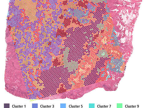 Spatial Biology | Applications | Nikon BioImaging Lab - USA | Nikon ...