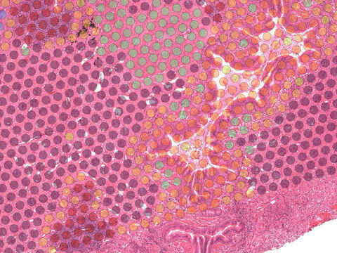 Spatial Biology | Applications | Nikon BioImaging Lab - USA | Nikon ...