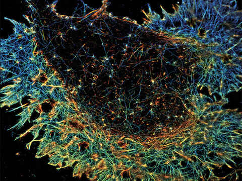 Super-Resolution | Applications | Nikon BioImaging Lab - Europe | Nikon ...