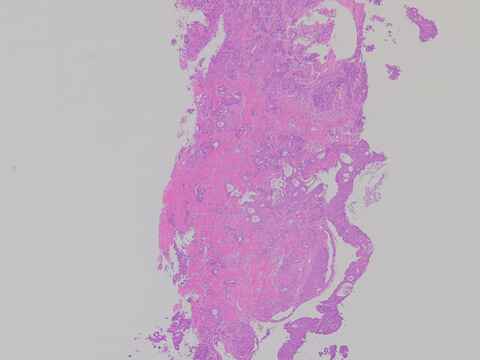 Gallery | ECLIPSE Ui | Digital Microscopes | Microscope Products ...