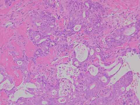 Gallery | ECLIPSE Ui | Digital Microscopes | Microscope Products ...