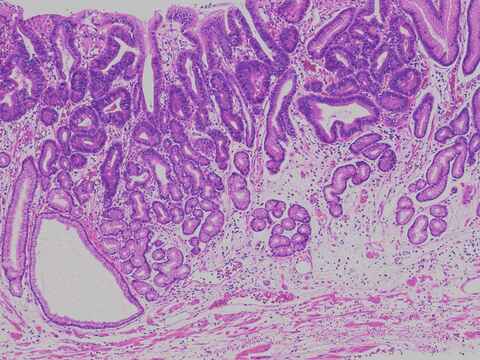 Gallery | ECLIPSE Ui | Digital Microscopes | Microscope Products ...