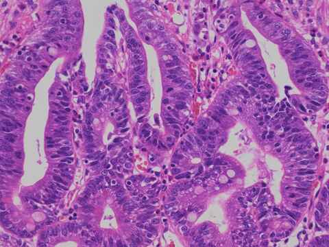 Gallery | ECLIPSE Ui | Digital Microscopes | Microscope Products ...