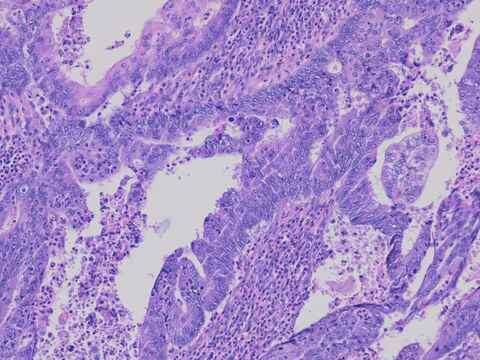 Gallery | ECLIPSE Ui | Digital Microscopes | Microscope Products ...