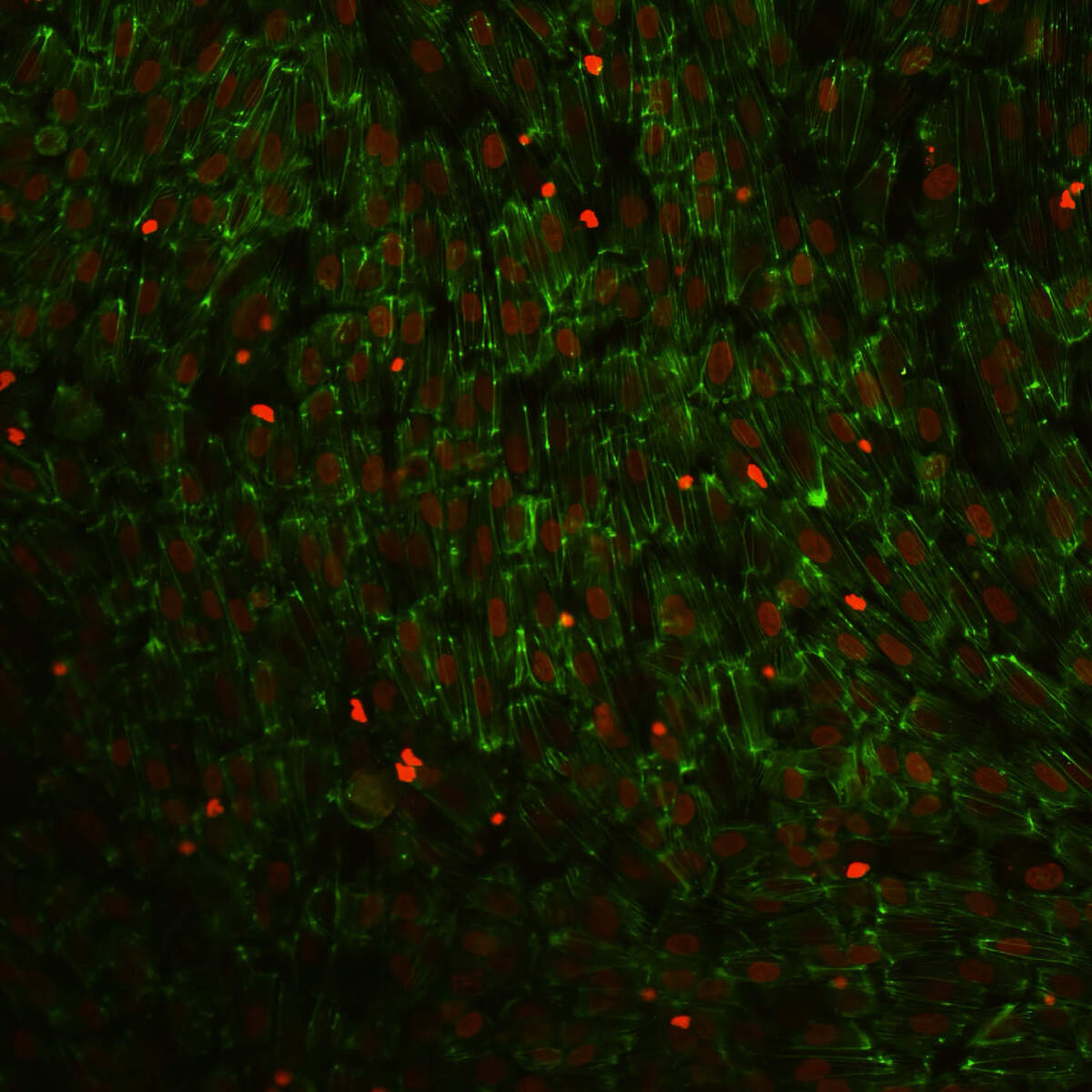 Transendothelial Migration | Applications | Nikon BioImaging Lab ...