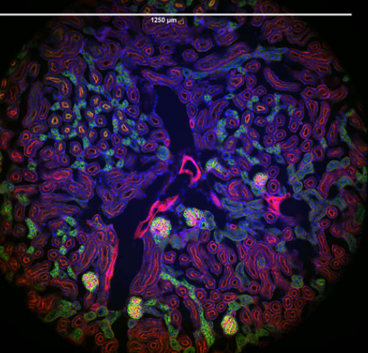 Crest X-Light V2 | Crest X-Light Series | Confocal Microscopes | Nikon ...