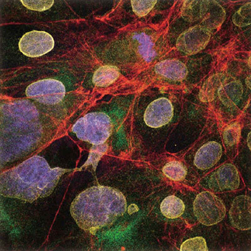 A1 HD25 / A1R HD25 | Confocal Microscopes | Nikon Microscope Products ...