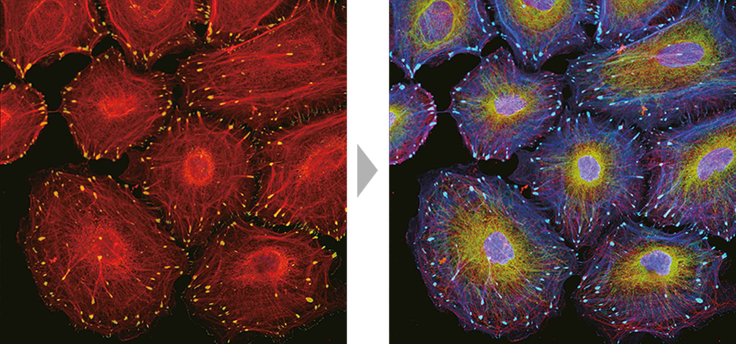 A1 HD25 / A1R HD25 | Confocal and Multiphoton Microscopes | Microscope ...