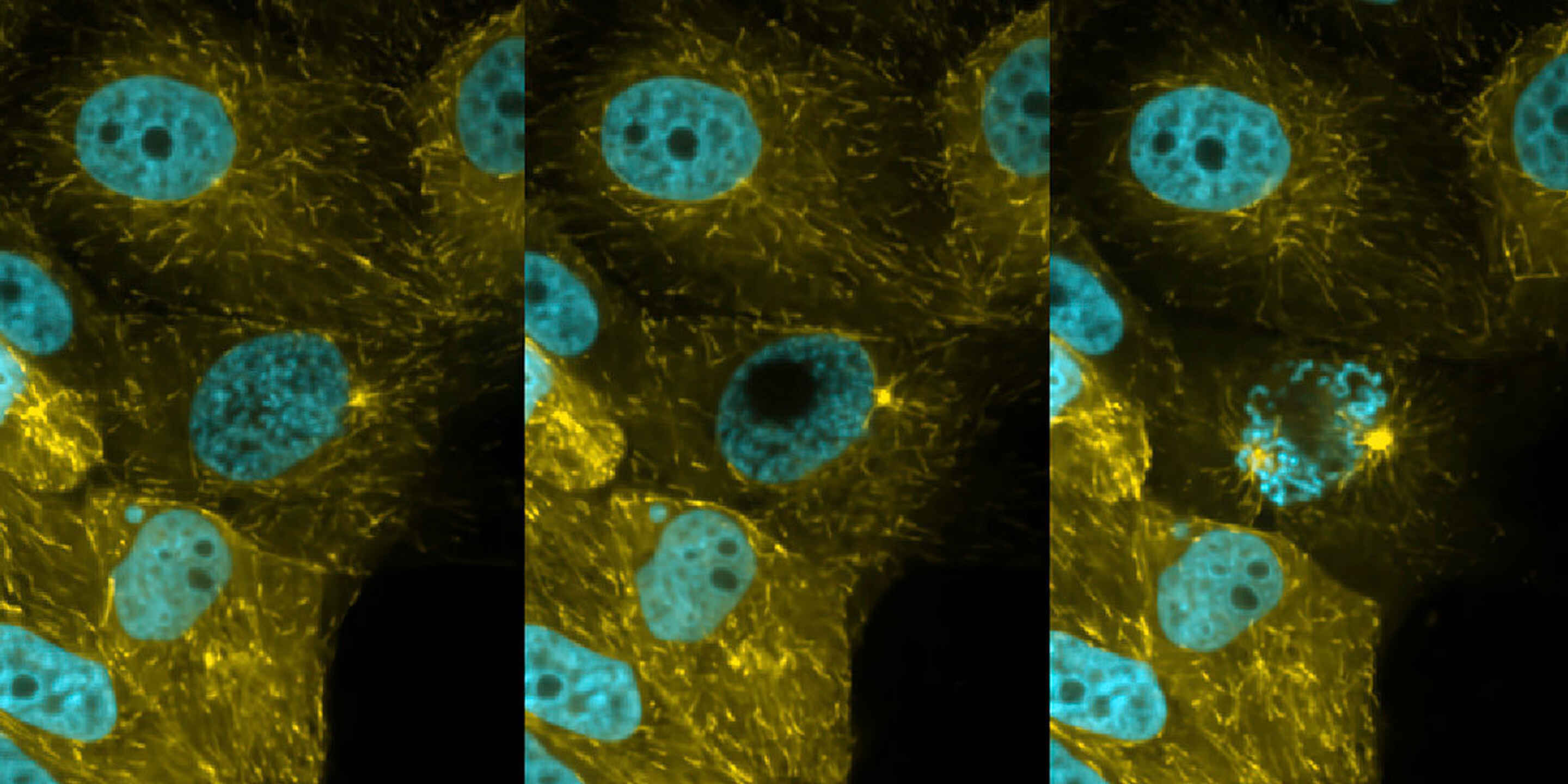 AX / AX R with NSPARC | Confocal and Multiphoton Microscopes ...