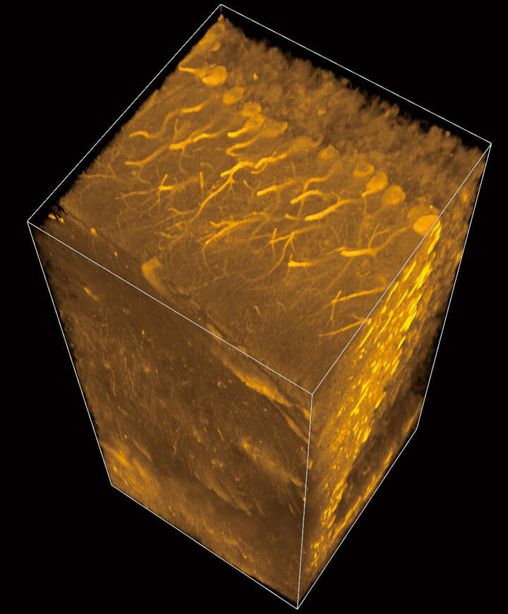 AX R MP with NSPARC | Confocal and Multiphoton Microscopes | Microscope ...