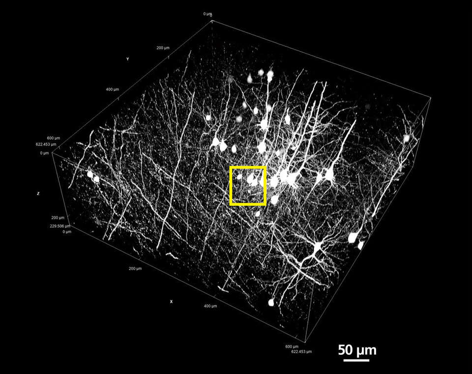 Ax R Mp With Nsparc Ax R Mp With Nsparc Confocal And Multiphoton