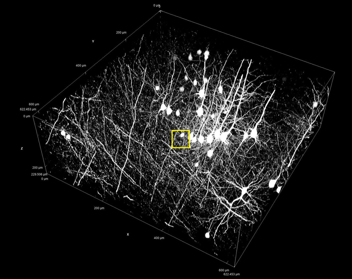 AX R MP with NSPARC | AX R MP with NSPARC | Confocal and Multiphoton ...