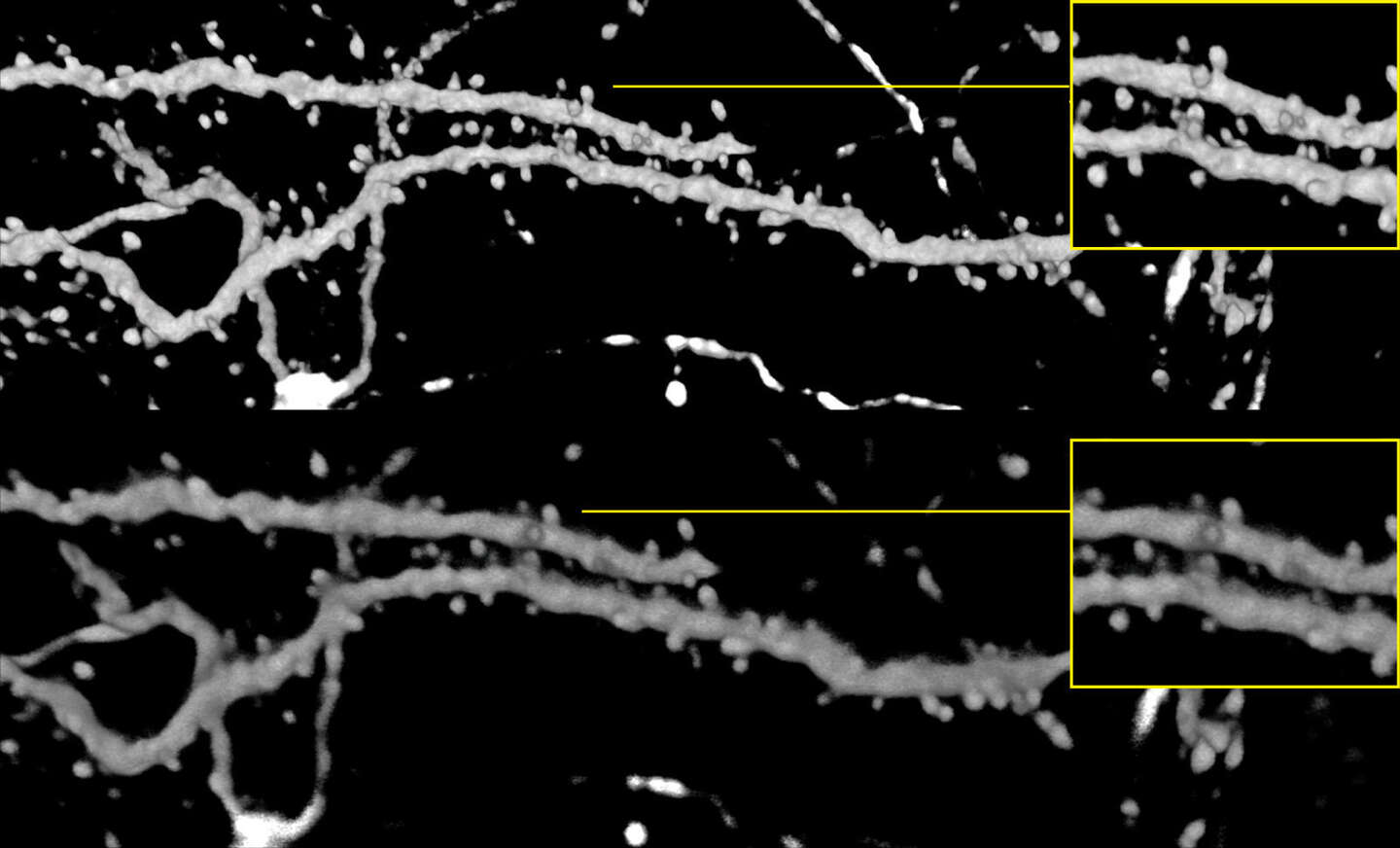 AX R MP with NSPARC | AX R MP with NSPARC | Confocal and Multiphoton Microscopes | Microscope ...