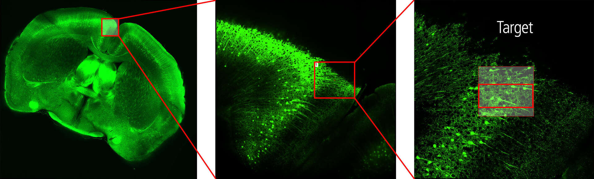 Super Resolution Imaging Of Myelin In Mouse Brain Using A Multiphoton