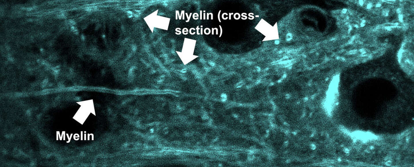 Super Resolution Imaging Of Myelin In Mouse Brain Using A Multiphoton