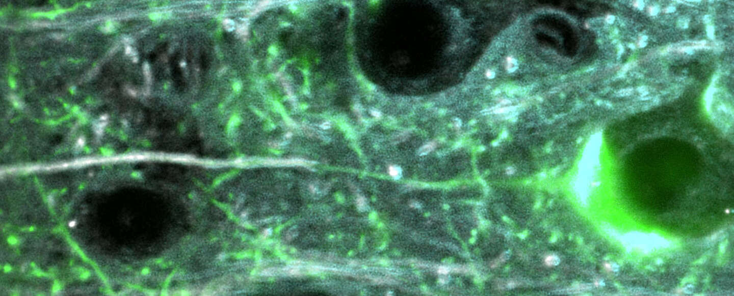 Super-resolution imaging of myelin in mouse brain using a multiphoton ...