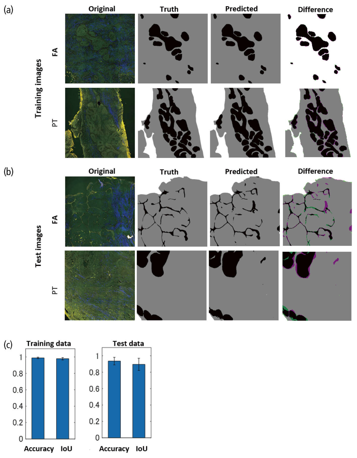 Diagnostic imaging of mixed connective tissue and epithelial tumors of ...