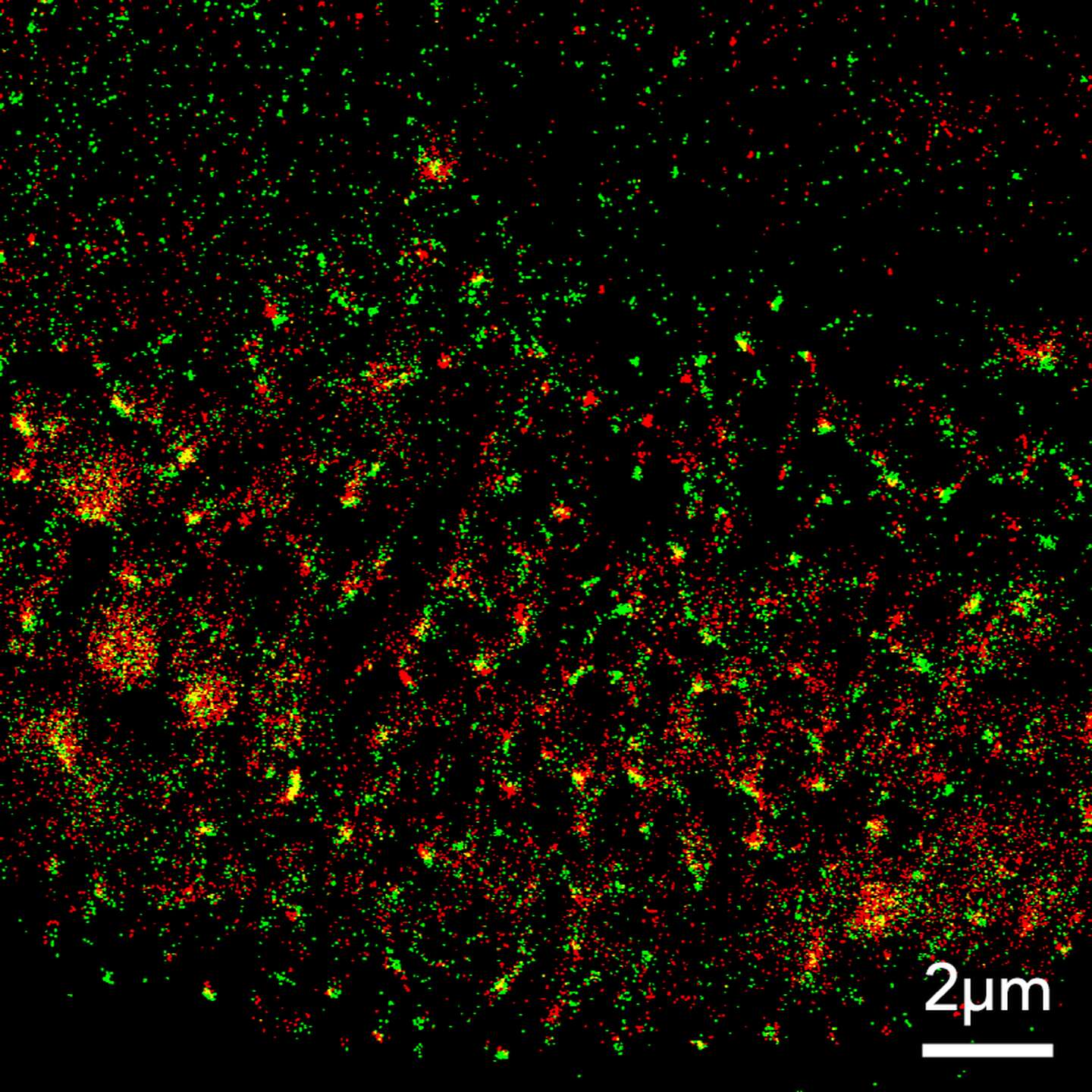 Protein components of virus particles in SARS-CoV-2-infected cells ...