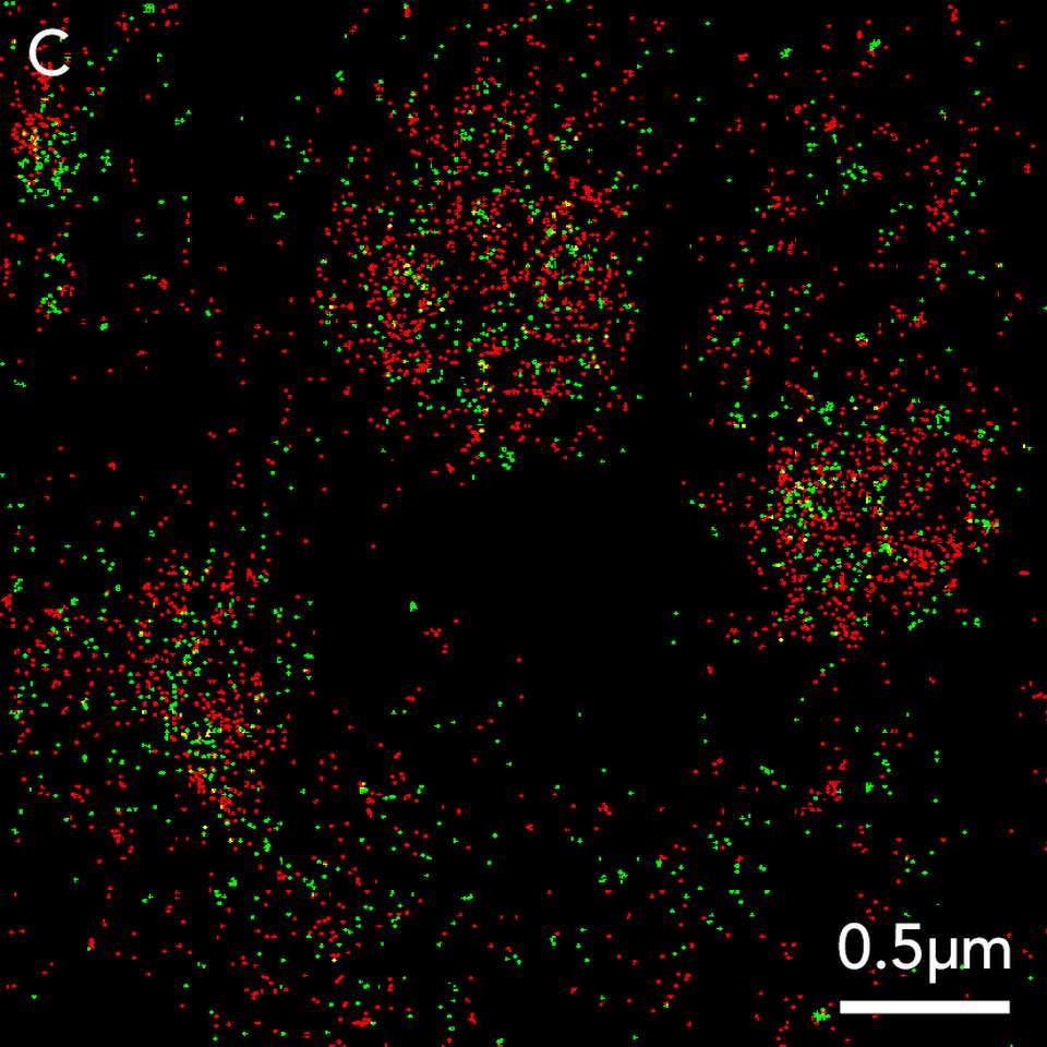 Protein components of virus particles in SARS-CoV-2-infected cells imaged by N-STORM super ...