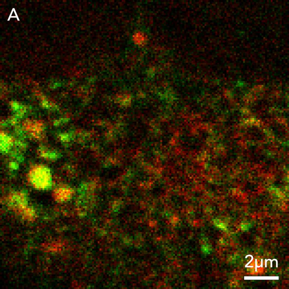 Protein components of virus particles in SARS-CoV-2-infected cells ...